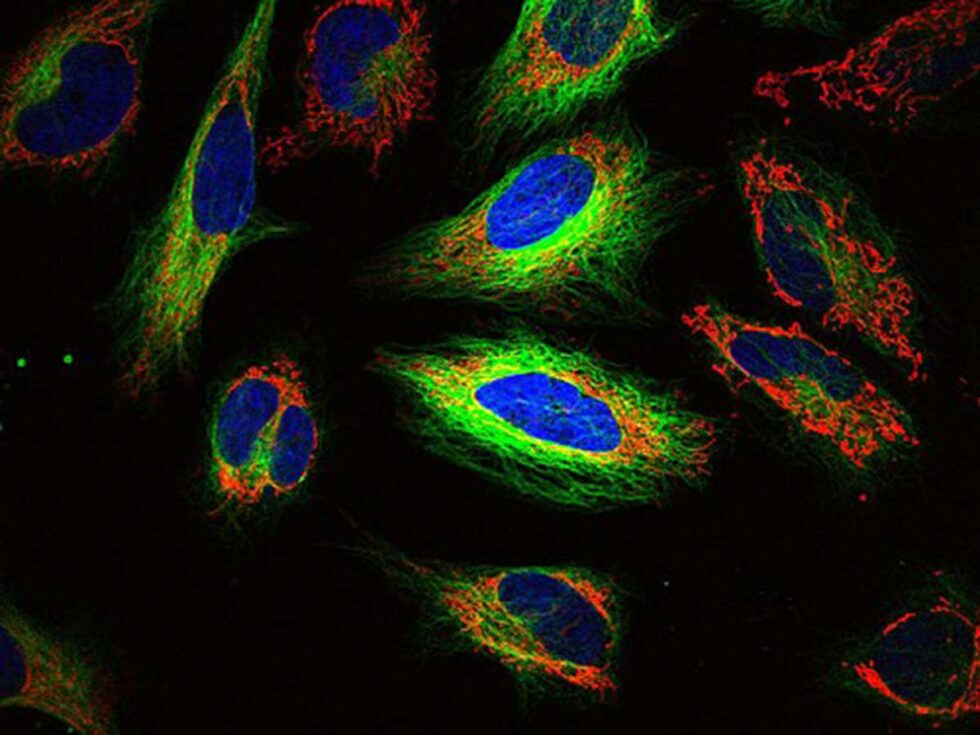 Best Microscope Products for Fluorescence Imaging