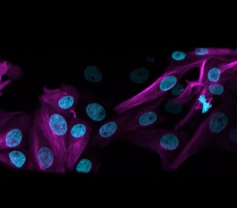 ZEISS Lattice Lightsheet 7: Advanced Microscopy for Live Cell Imaging